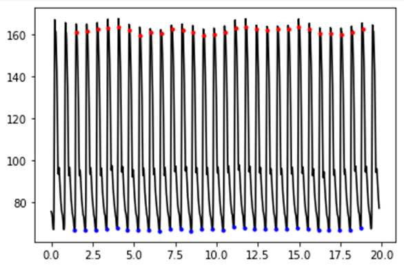 GitHub - RikinBasu/PPG-signal-to-detect-an-elevated-shock-index: The ...