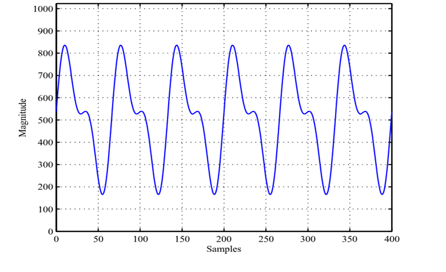 GitHub - RikinBasu/PPG-signal-to-detect-an-elevated-shock-index: The ...