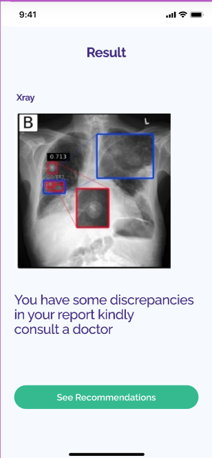 GitHub - bijin-s/iScan: innohacks competiton