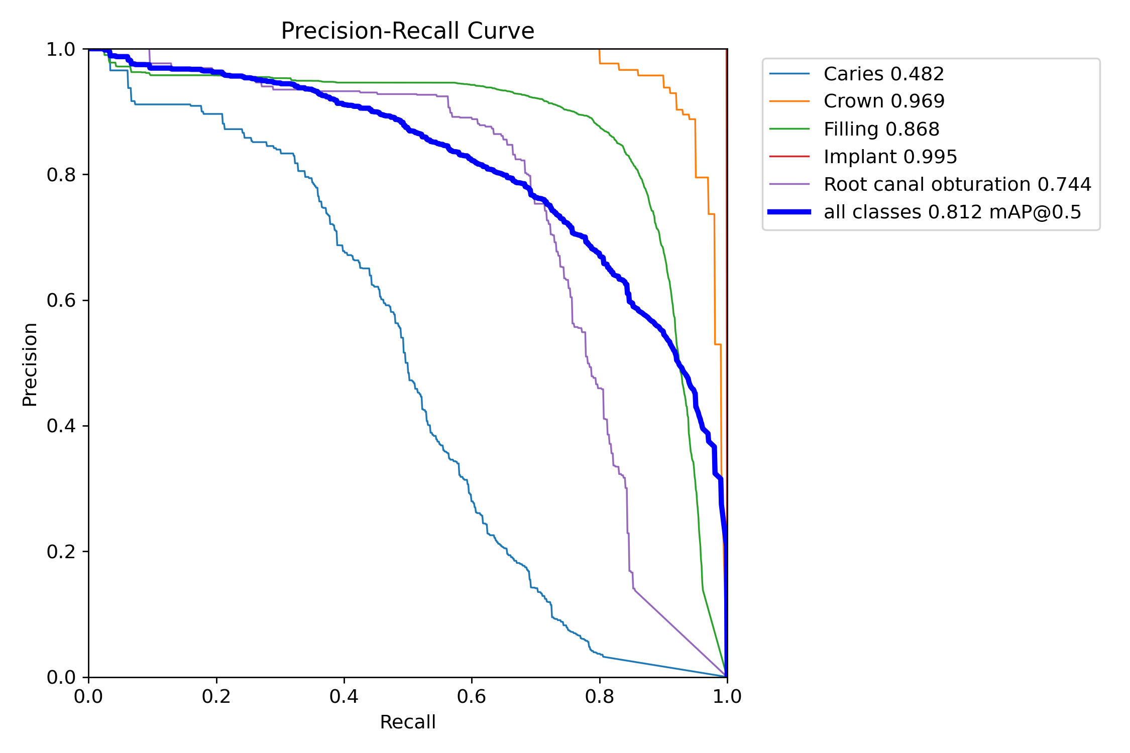 GitHub - DaliaAlzubi/yolo8-Paoramic_Segmentation