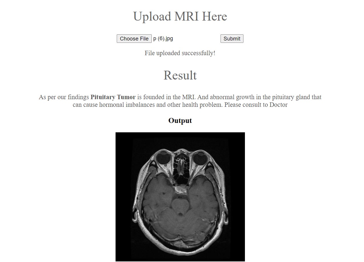 GitHub - SaurabhSharma2388/Brain_Tumor_Detection_website1