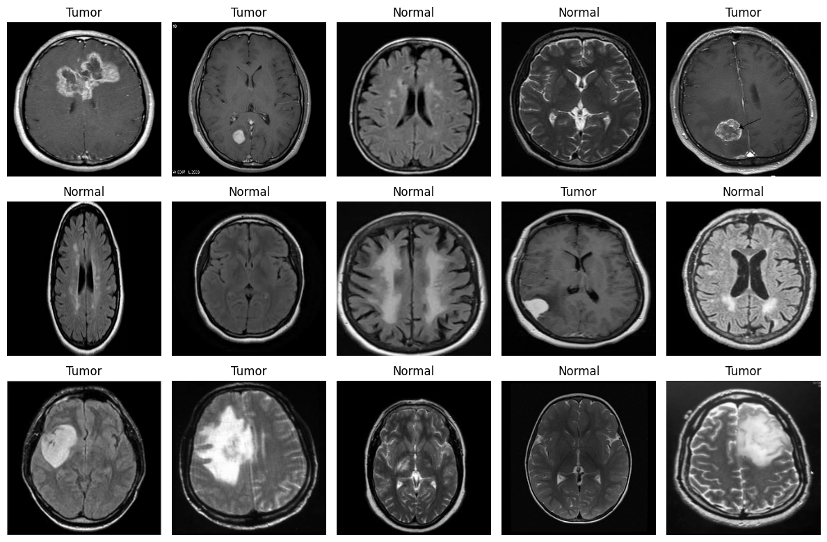 Github Edjr94 Brain Tumor Detection