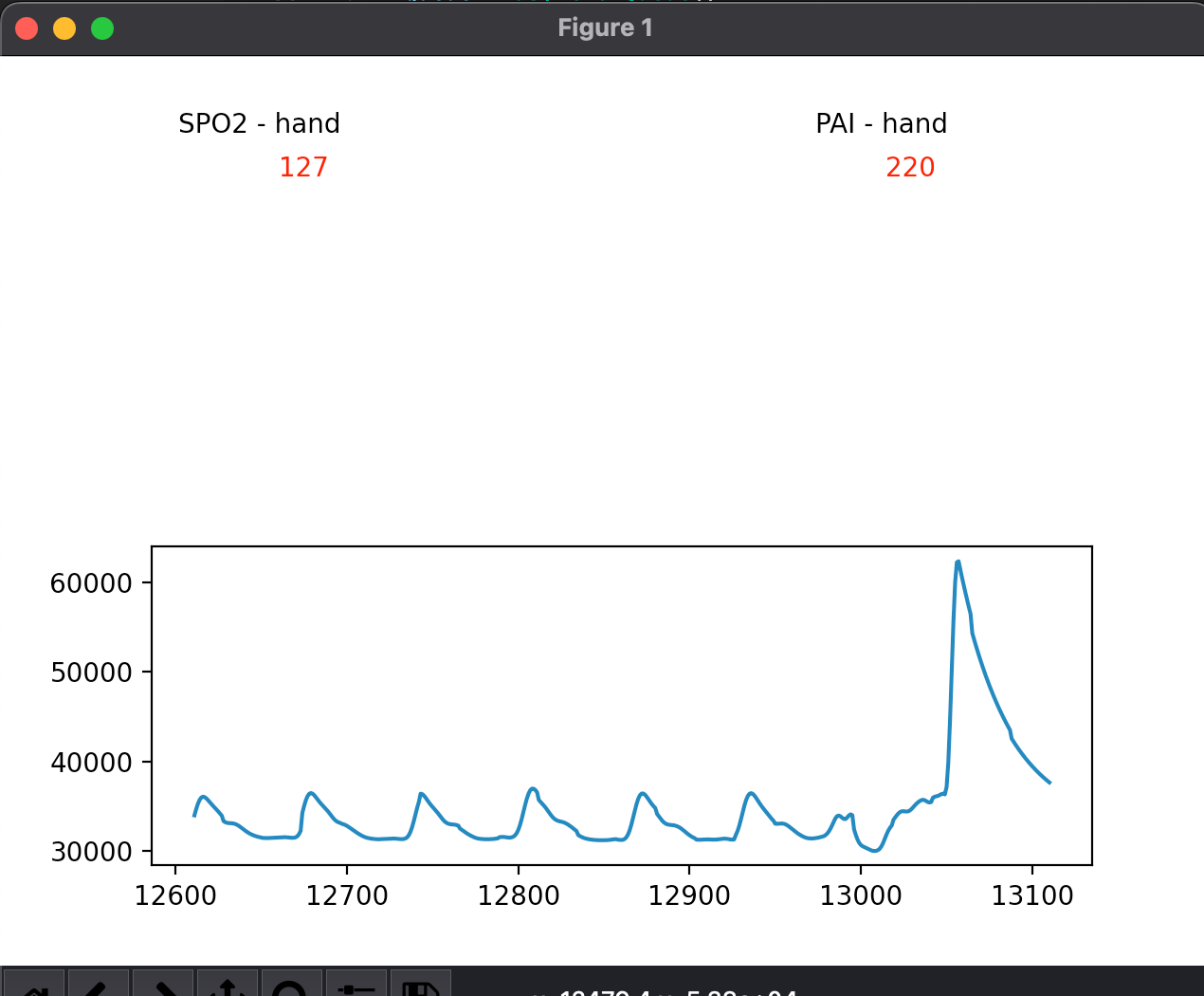 Github Wasdwasd0105nonin3150blepython A Python Program Can Receive Record And Plot Nonin 0681