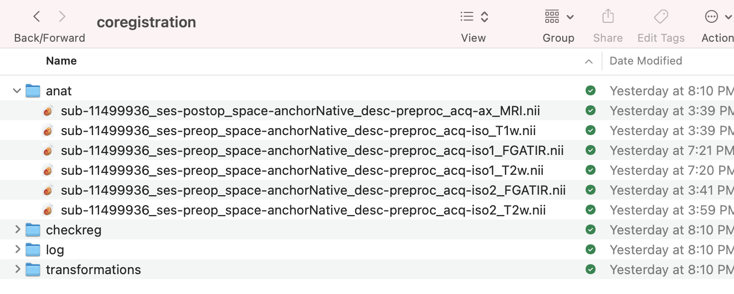 iso vs iso1 issue in lead migrate · Issue #906 · netstim/leaddbs · GitHub