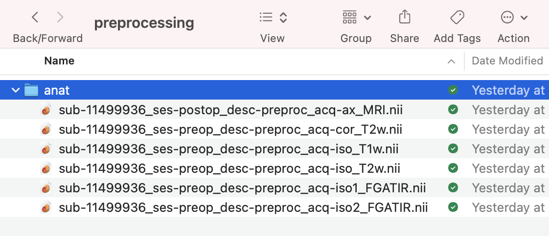 iso vs iso1 issue in lead migrate · Issue #906 · netstim/leaddbs · GitHub