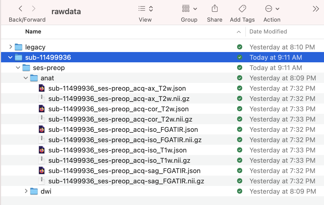 iso vs iso1 issue in lead migrate · Issue #906 · netstim/leaddbs · GitHub