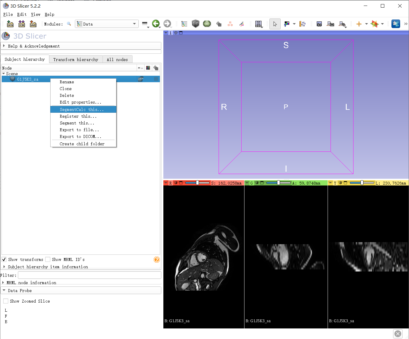 GitHub - shine636363/CMR4Slicer