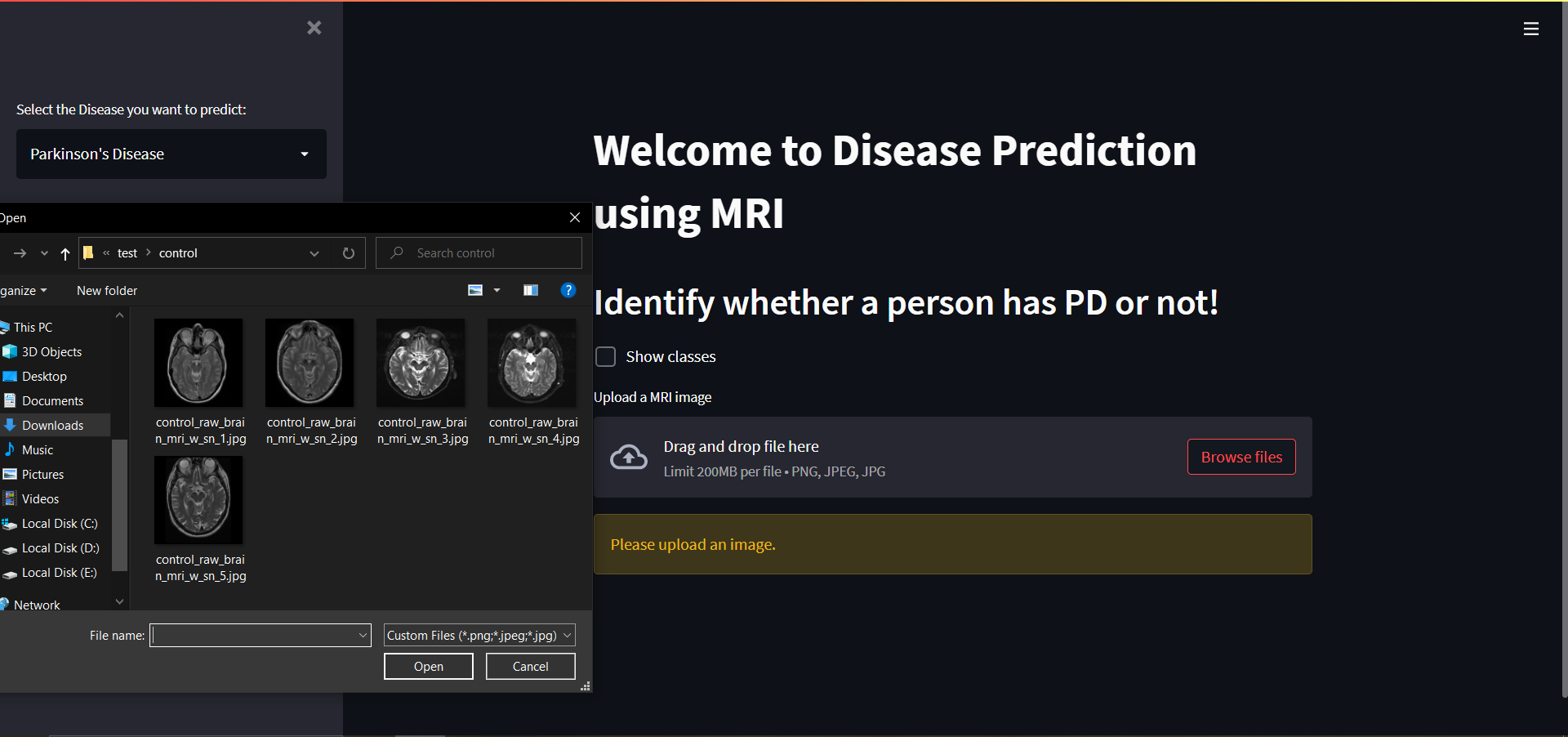 GitHub - Floofy-psk/PD-Prediction-Model-Deployment-on-Azure-Cloud: This project deploys a deep ...