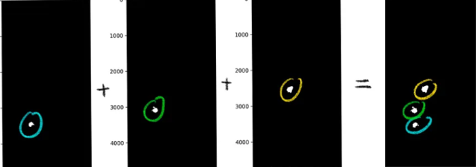 GitHub - mohamed-ben-ticha/Working-on-the-CBIS-DDSM-data-set