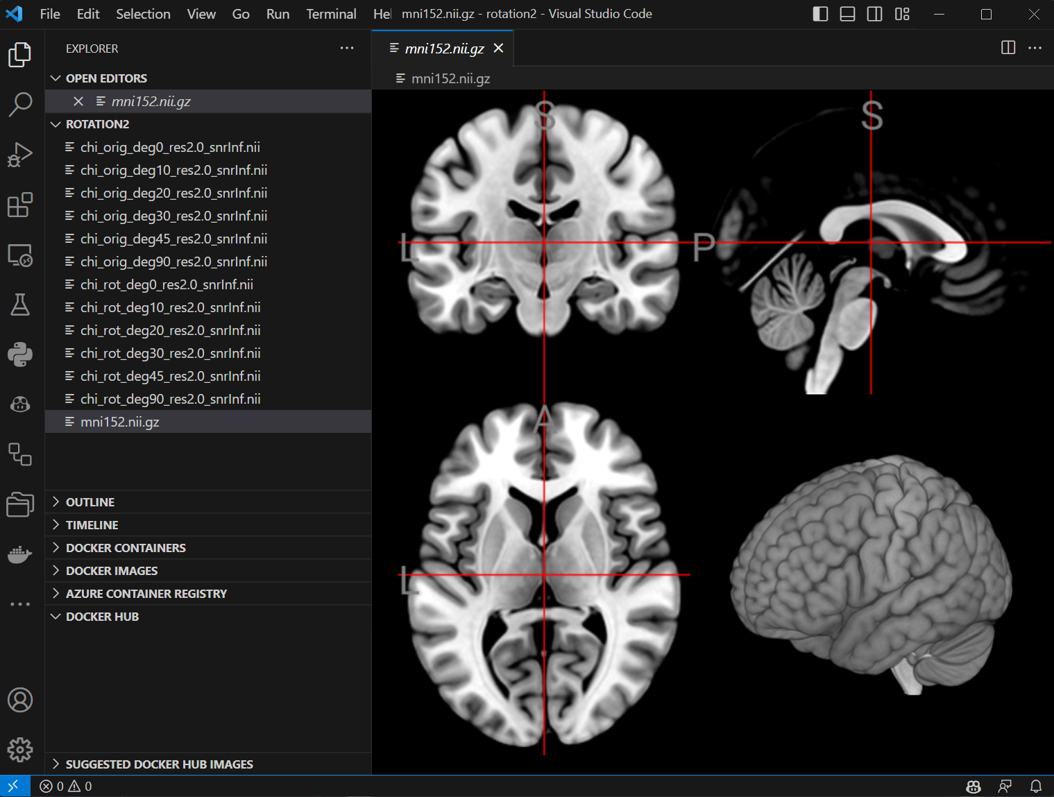 vscode extension for NiiVue · Issue #665 · niivue/niivue · GitHub