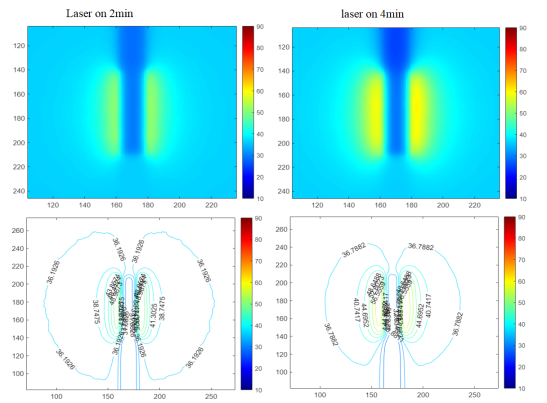 GitHub - Daiyaoxu/Simulation-of-laser-induced-interstitial ...