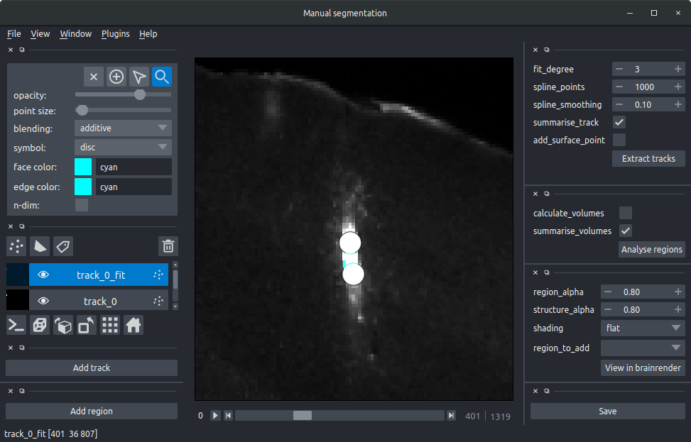 probe segmentation in whole-brain data · Issue #13 · SainsburyWellcomeCentre/neuro · GitHub