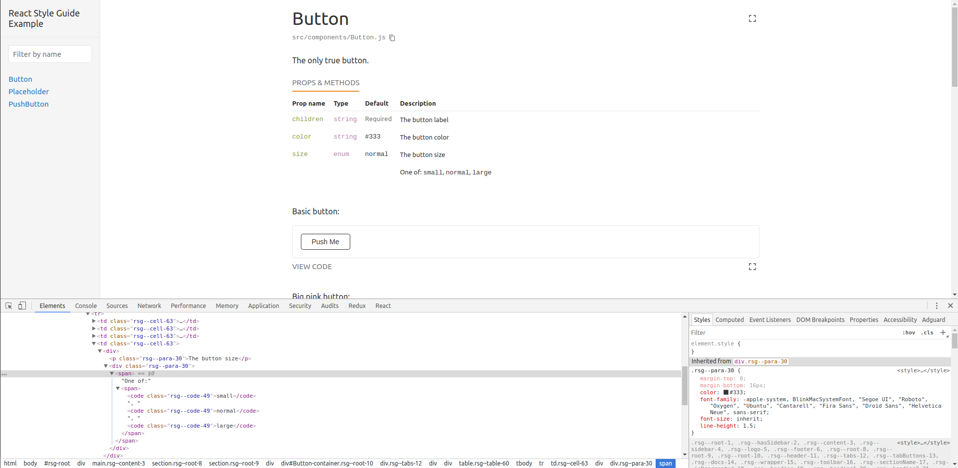 [Flow] Problem with union and literal props not displaying correctly · Issue #1032 ...
