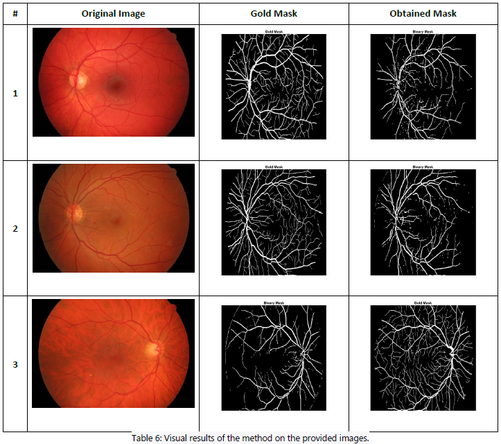 GitHub - AmirTabatabaei-git/BloodVesselSeg-Fundus: Segmentation of blood vessels in fundus ...