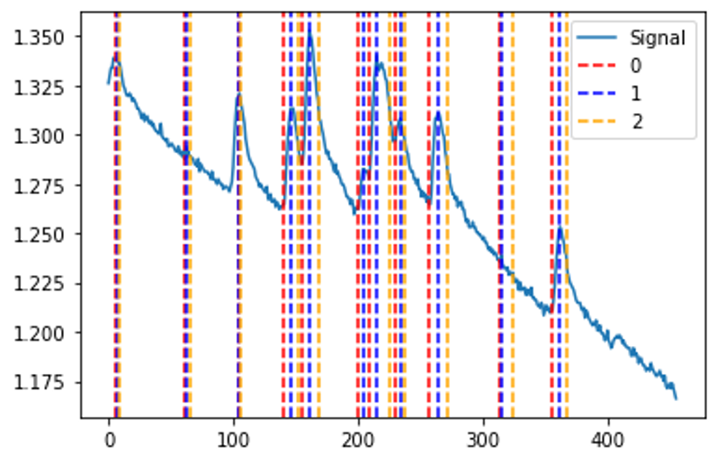 Questions On Eda Processing With Neurokit2 · Issue 851