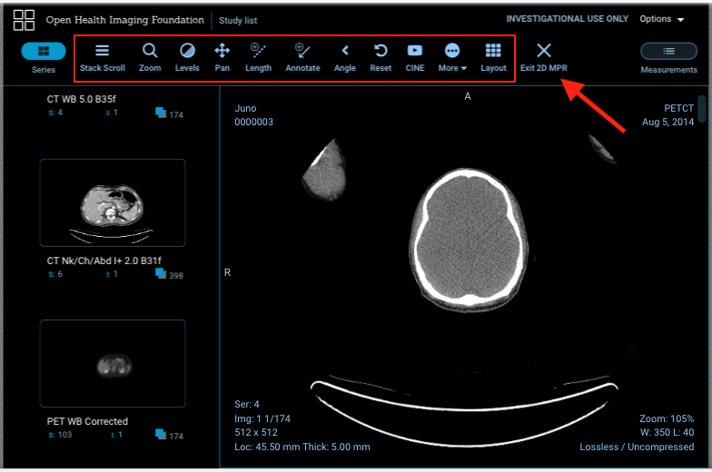 VTK toolbar is not displayed if user clicks on 2D MPR button before image loads in viewport ...