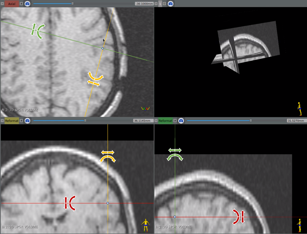 Interactive slice intersections · Issue #5544 · Slicer/Slicer · GitHub