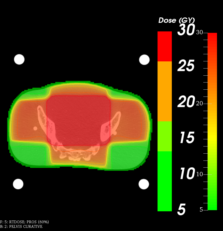 Display dose map colorbar in 2D view · Issue #51 · SlicerRt/SlicerRT · GitHub