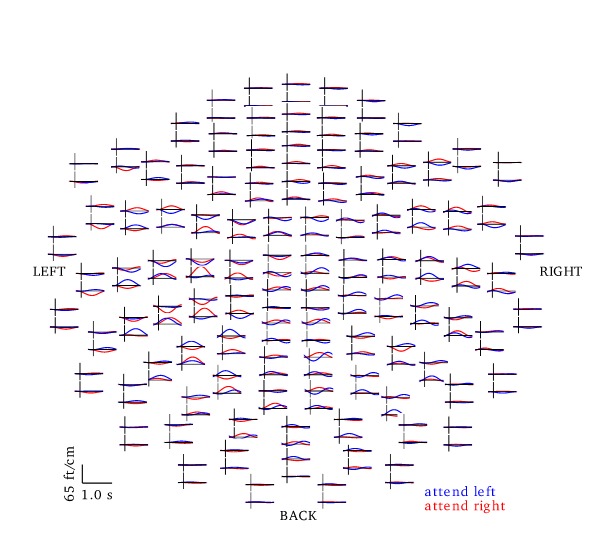 ENH: Adding a scale legend to plot_topo and other plotting functions ...
