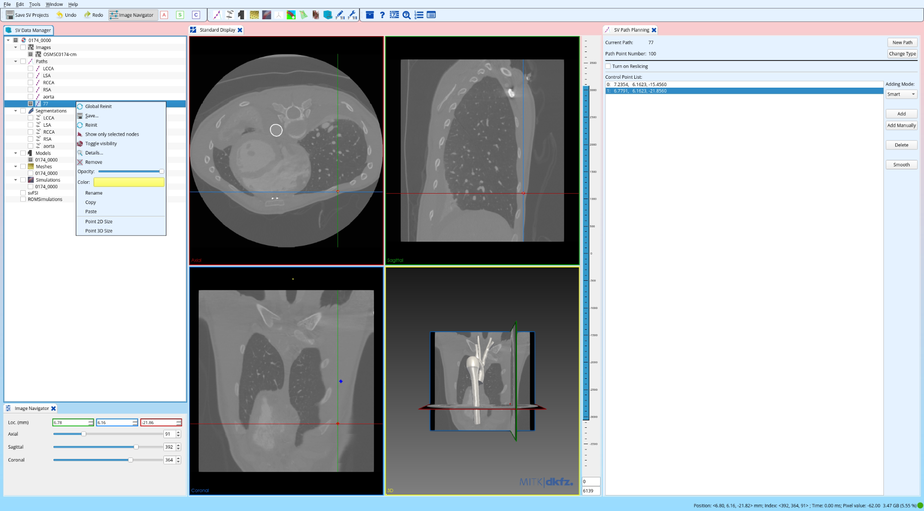 Update external libraries · Issue #1010 · SimVascular/SimVascular · GitHub