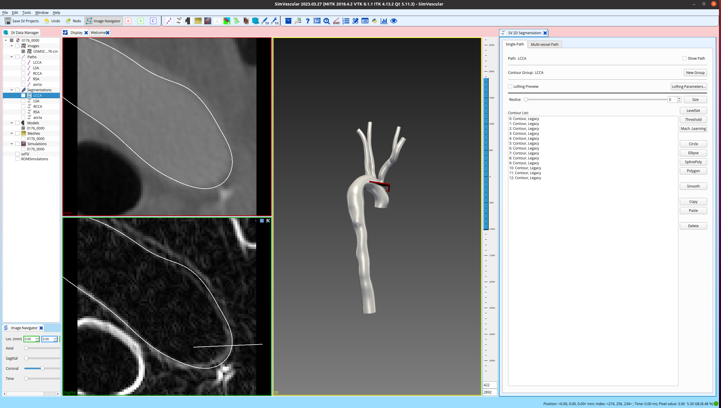 Fixing segmentation tool in SimVascular version with new Externals · Issue #1033 · SimVascular ...