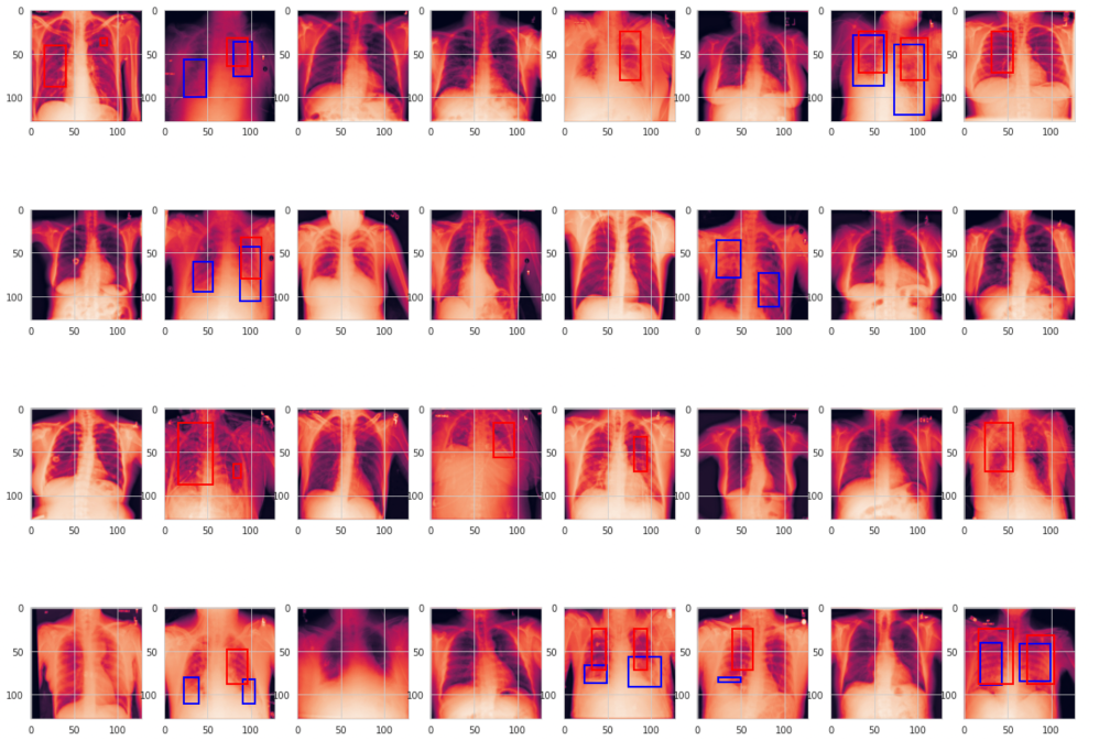 Github Jowher Pneumonia Detection Aiml Project Python Project Report