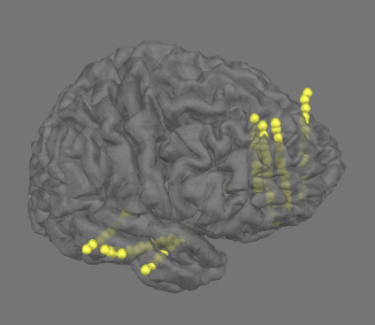 MNE version? · Issue #1 · UMCU-RIBS/ieeg-fmri-dataset-quickstart · GitHub