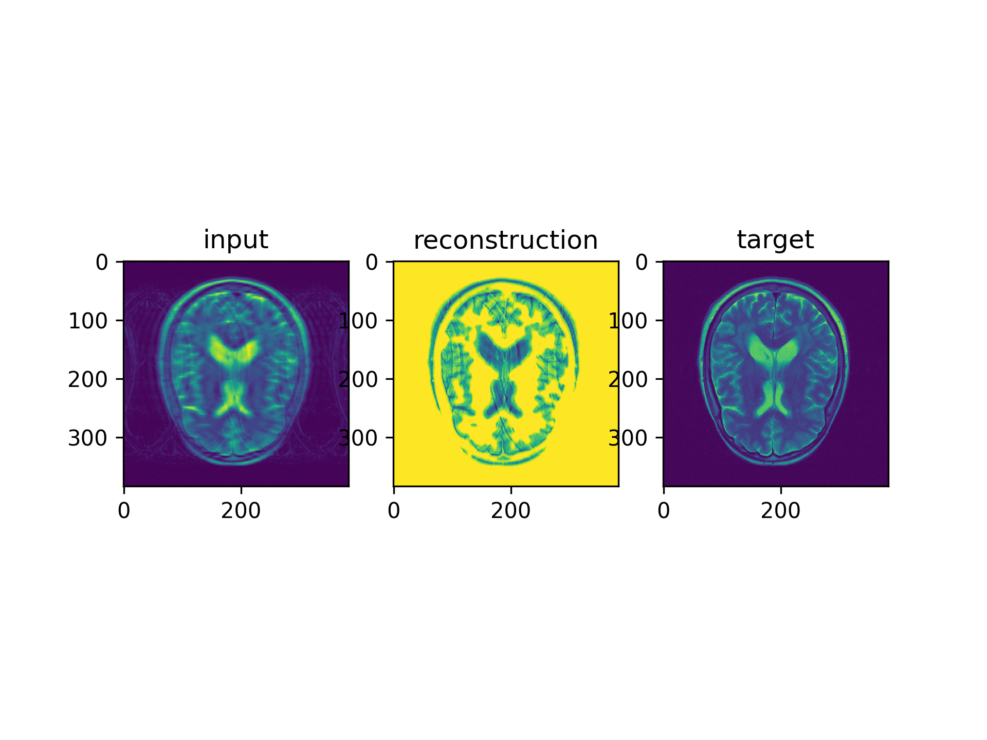 기존 train.py를 사용했을 때 reconstruction image가 반전되어서 나오는 것처럼 보입니다. · Issue #184 · LISTatSNU/FastMRI ...