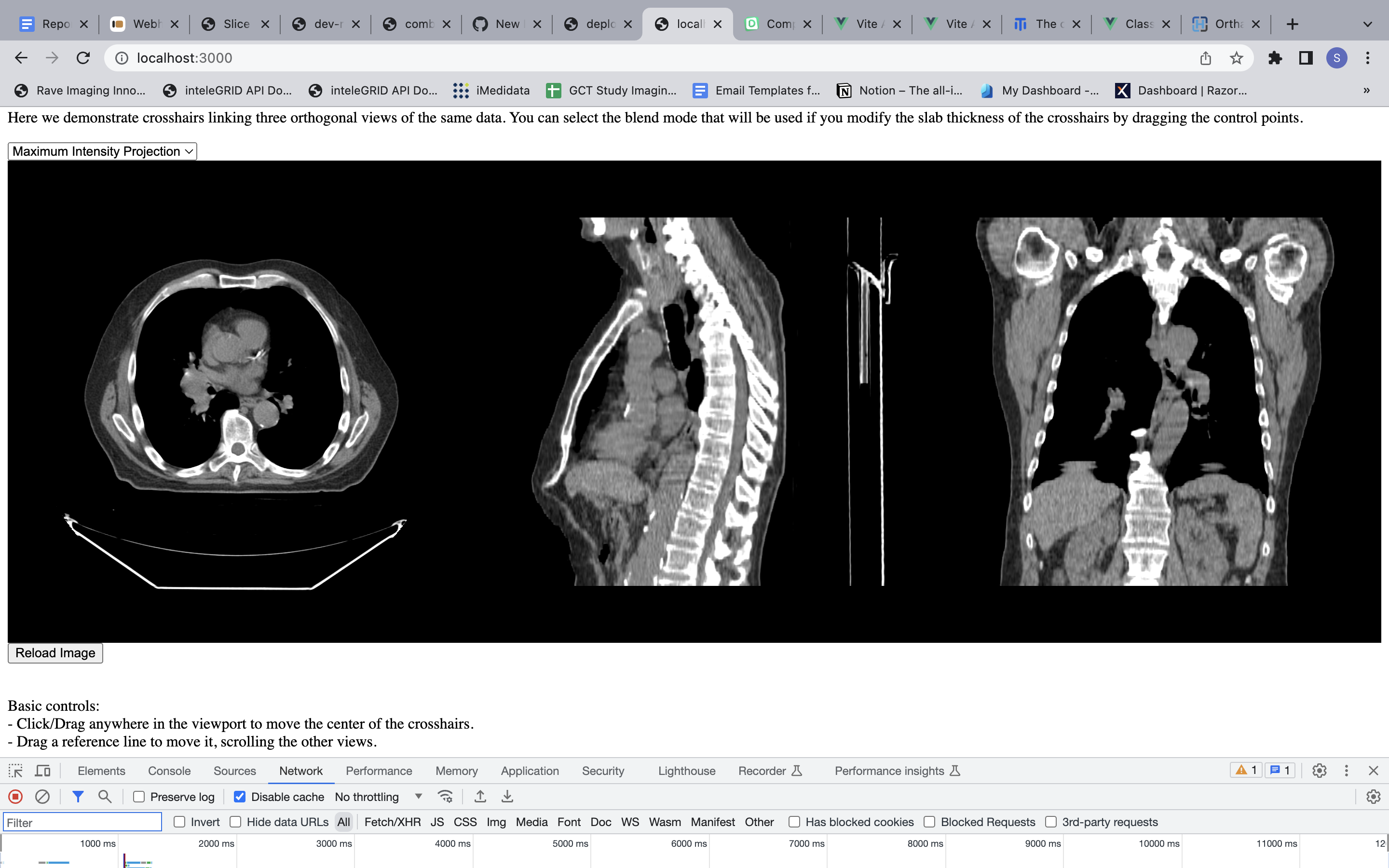 [Bug] Unable to reload same data on the same viewport · Issue #695 · cornerstonejs/cornerstone3D ...