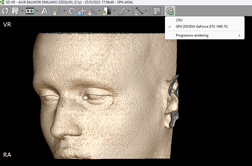 PROBLEM: Weasis can't find my graphic card · Issue #420 · nroduit/Weasis · GitHub