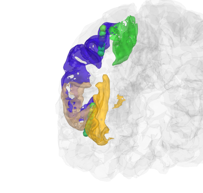 [BUG] Swiss cheese structures in `mne.viz.Brain.add_volume_labels ...