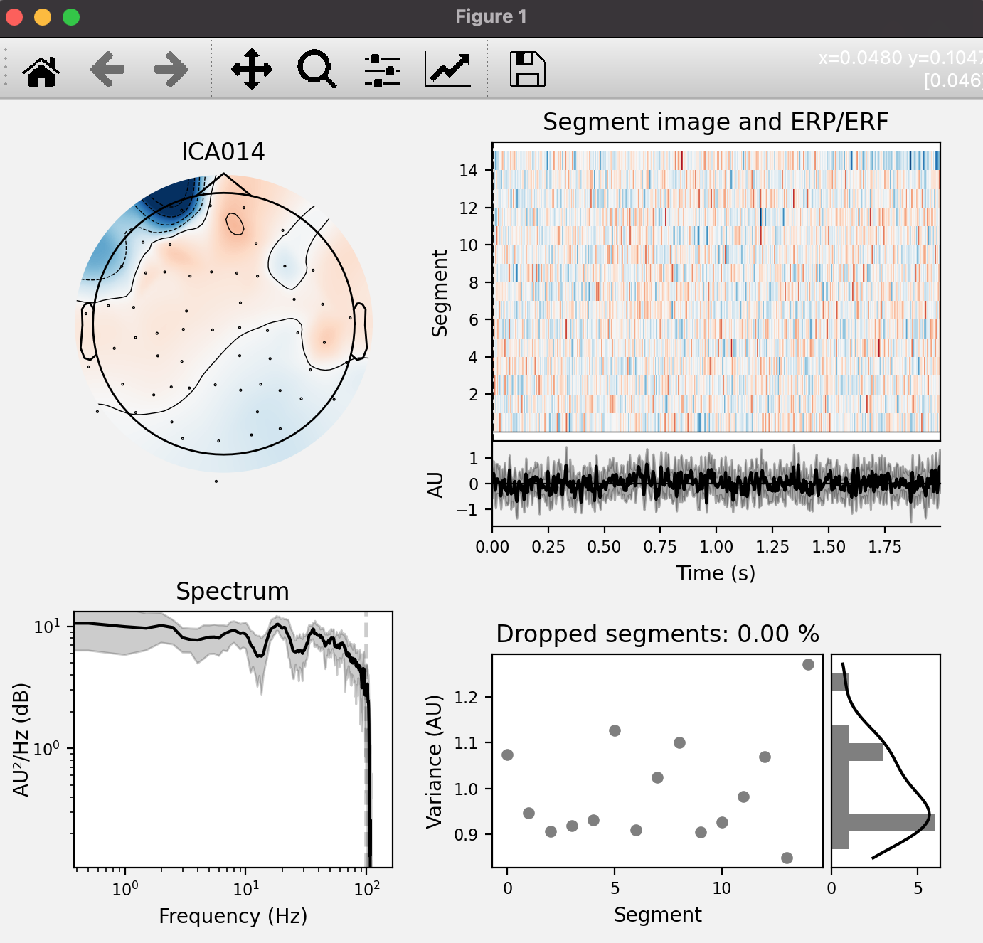 [BUG] Muscle artifact detection does not replicate MNE example · Issue ...