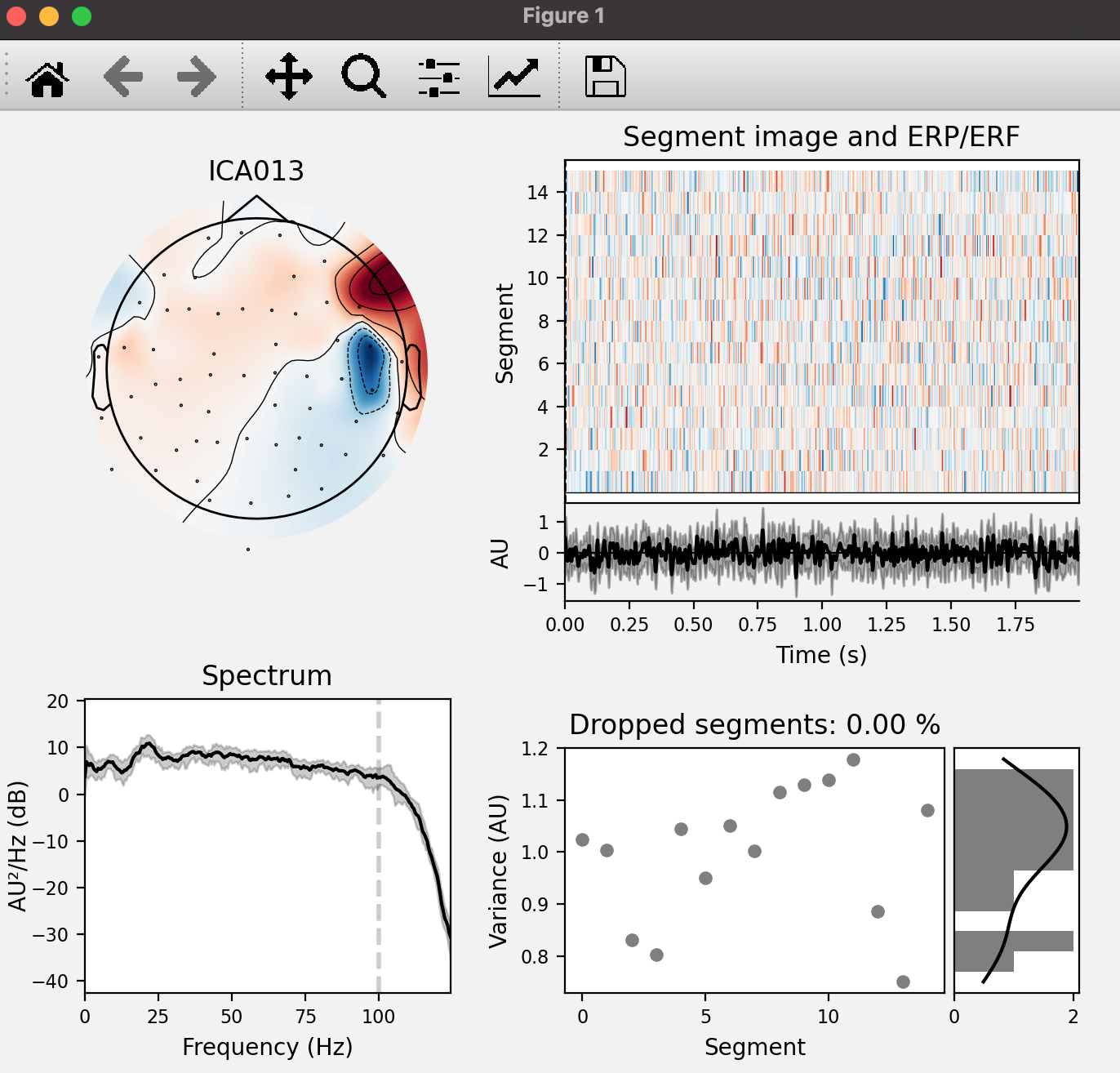 [BUG] Muscle artifact detection does not replicate MNE example · Issue ...