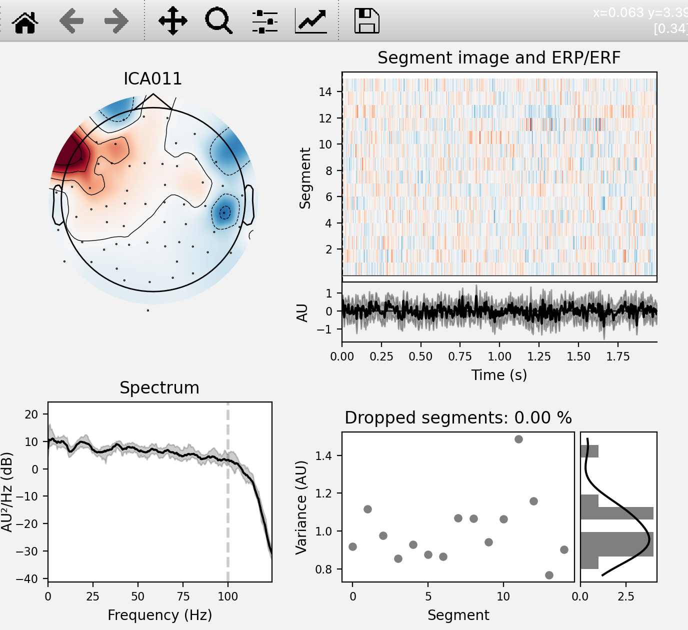[BUG] Muscle artifact detection does not replicate MNE example · Issue ...