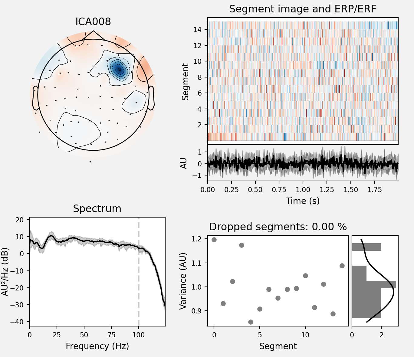 [BUG] Muscle artifact detection does not replicate MNE example · Issue ...