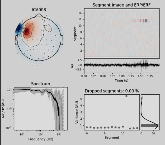 [BUG] Muscle artifact detection does not replicate MNE example · Issue ...