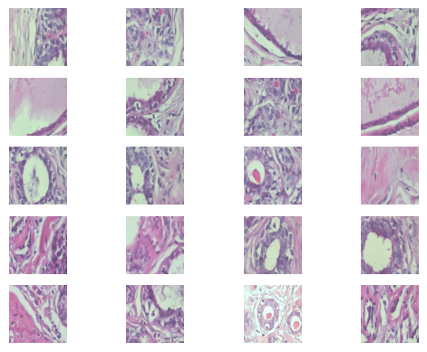 GitHub - ChakradharMudili/Breast_Cancer_Deep_Learning: Deep learning ...