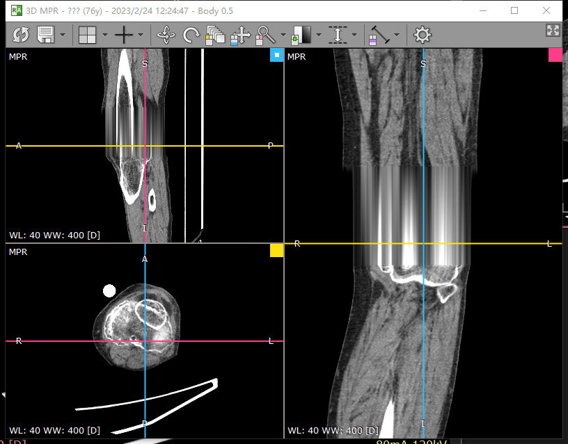 [Bug] · Issue #659 · cornerstonejs/cornerstone3D · GitHub