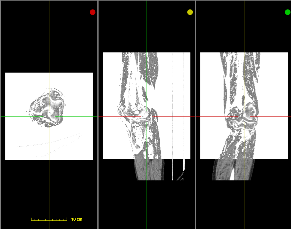 [Bug] · Issue #659 · cornerstonejs/cornerstone3D · GitHub