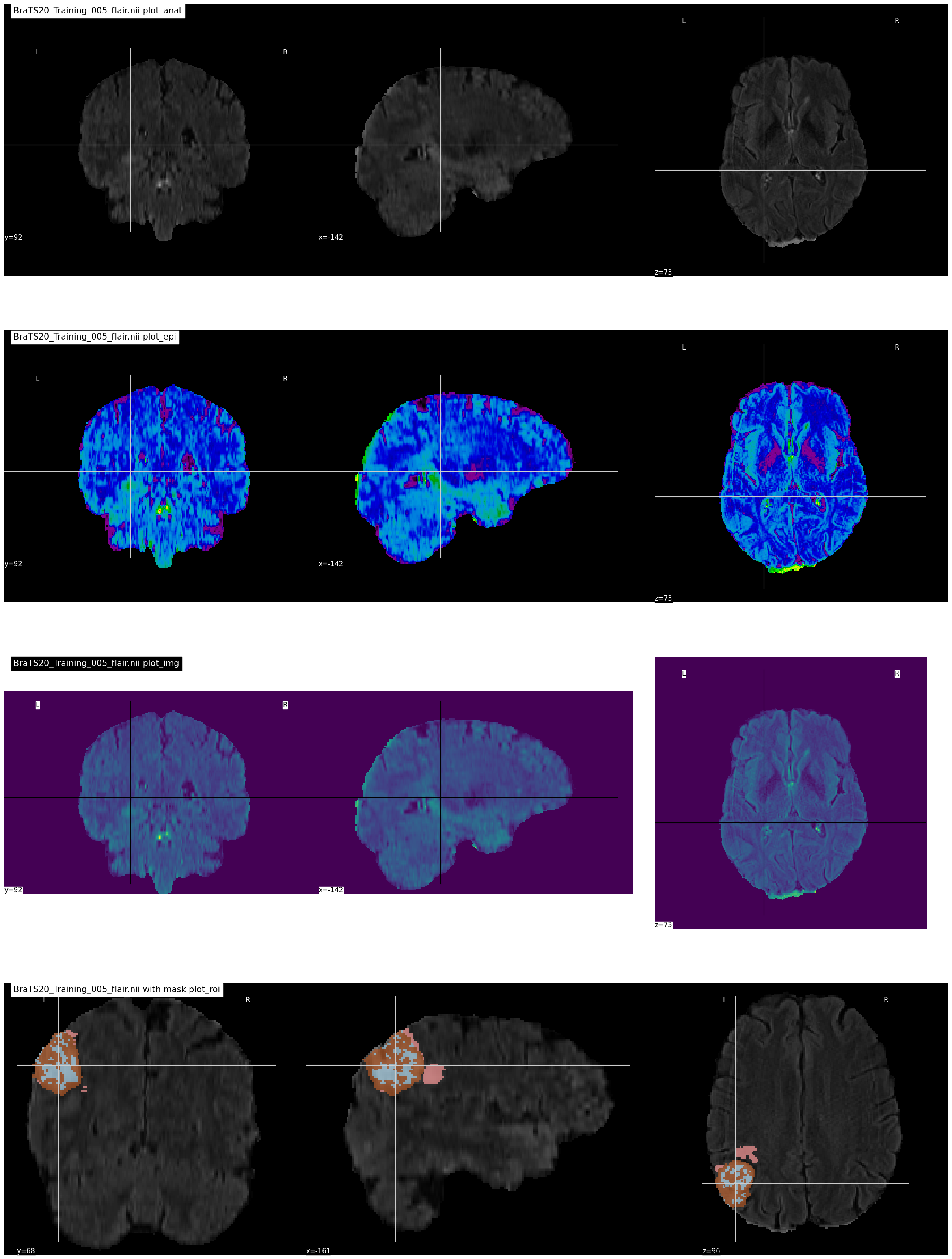 GitHub - nadiasuweer4ya/TumorVision-Intelligent-Brain-Tumor-Analysis ...