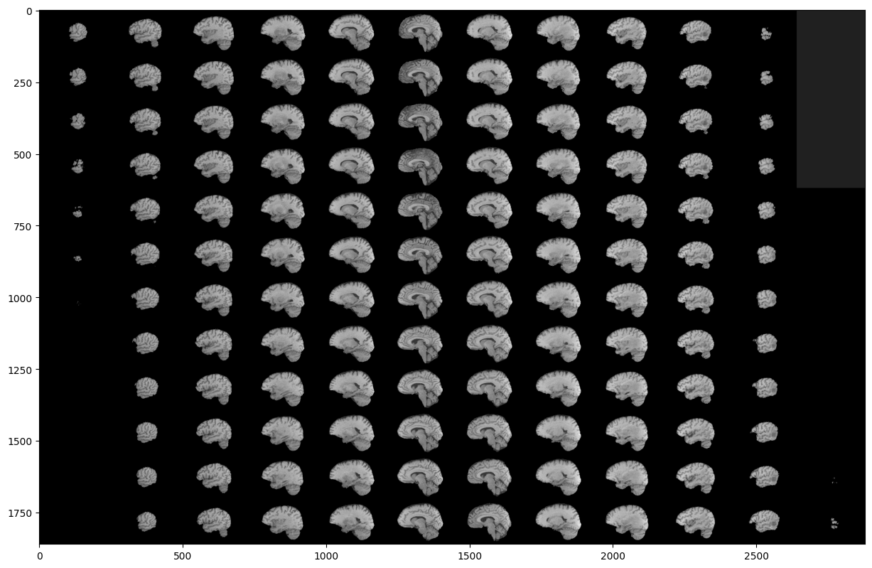 GitHub - nadiasuweer4ya/TumorVision-Intelligent-Brain-Tumor-Analysis ...