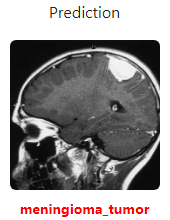GitHub - IMSoley/PredBrainTumor: A deep learning model for predicting ...