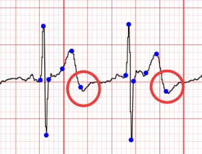 SDK functionalities to configure the polar H10 with several features · Issue #307 ...