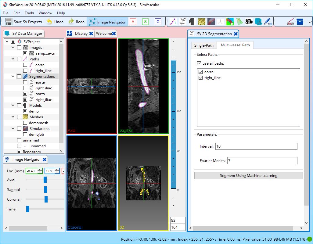 BUG: multi-segmentation using ML can create duplicate group names that overwrite existing groups ...