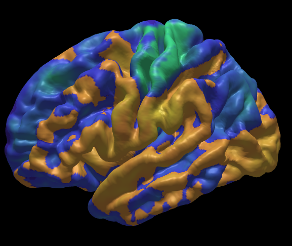 Collaboration with NiiVue and possibilities for integration · Issue ...