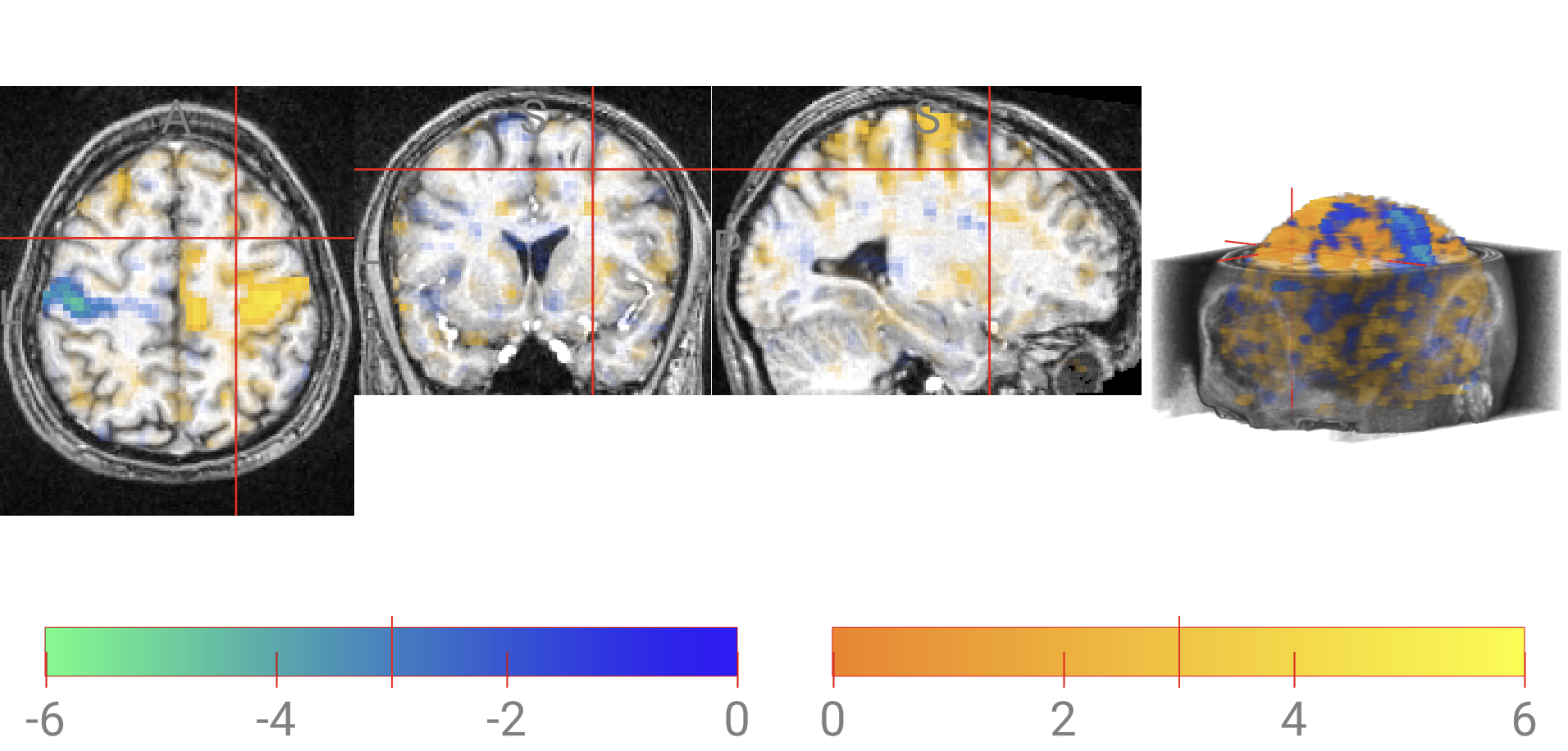 Collaboration with NiiVue and possibilities for integration · Issue ...