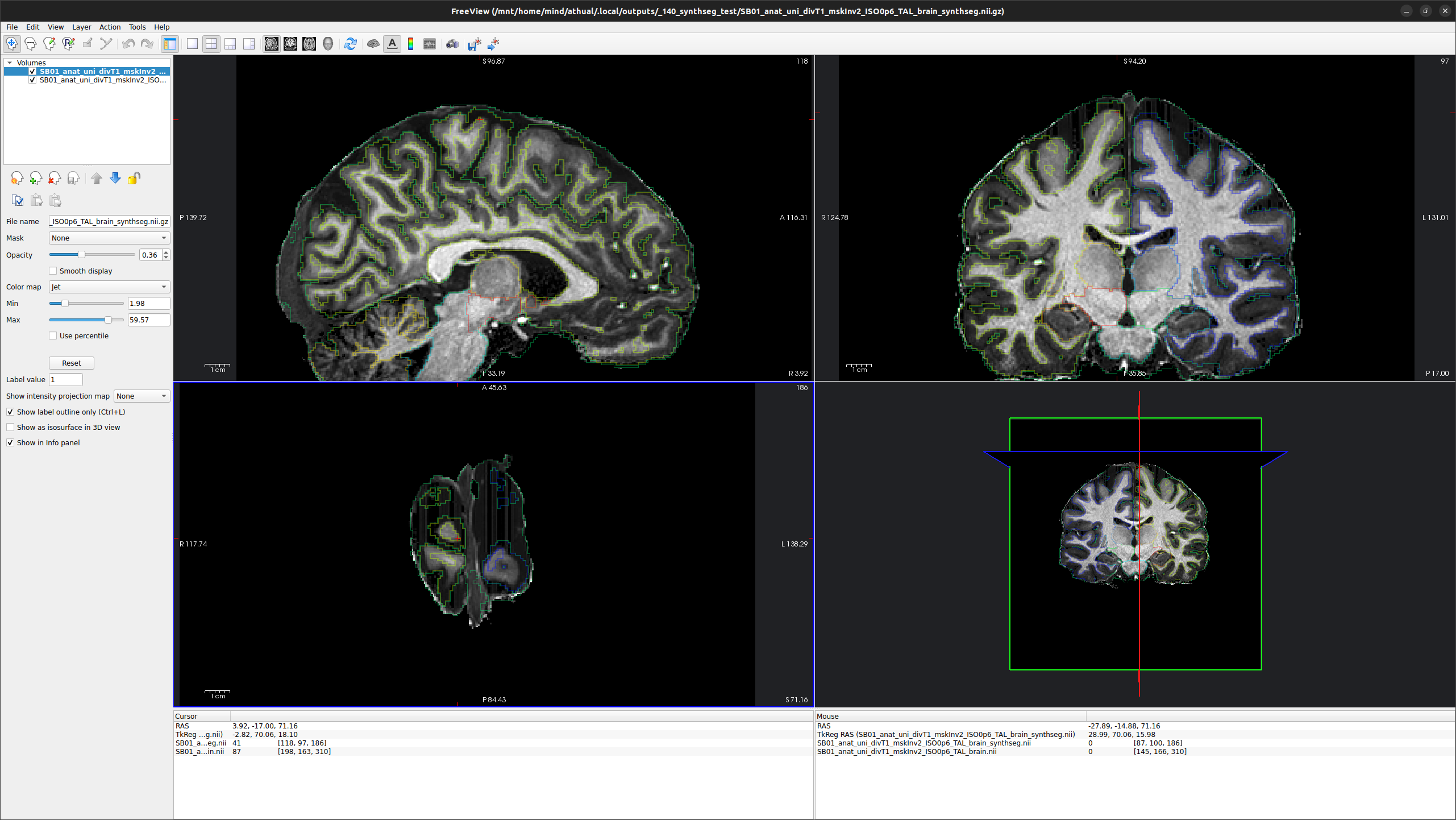 High resolution T1w image segmentation seems · Issue #60 · BBillot/SynthSeg · GitHub