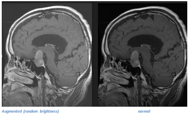 GitHub - ioptime-official/ai-brain-tumor-classification