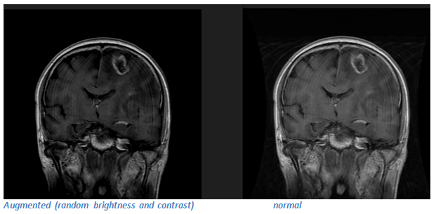 GitHub - ioptime-official/ai-brain-tumor-classification