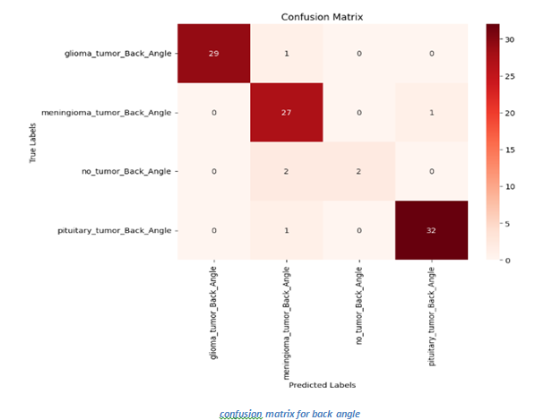 GitHub - ioptime-official/ai-brain-tumor-classification